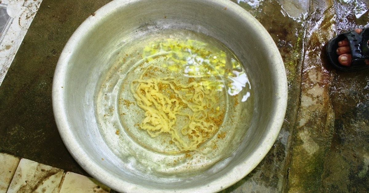 “Chung sống” với sán xơ mít dài 12m trong ruột suốt 4 năm | Báo Dân trí